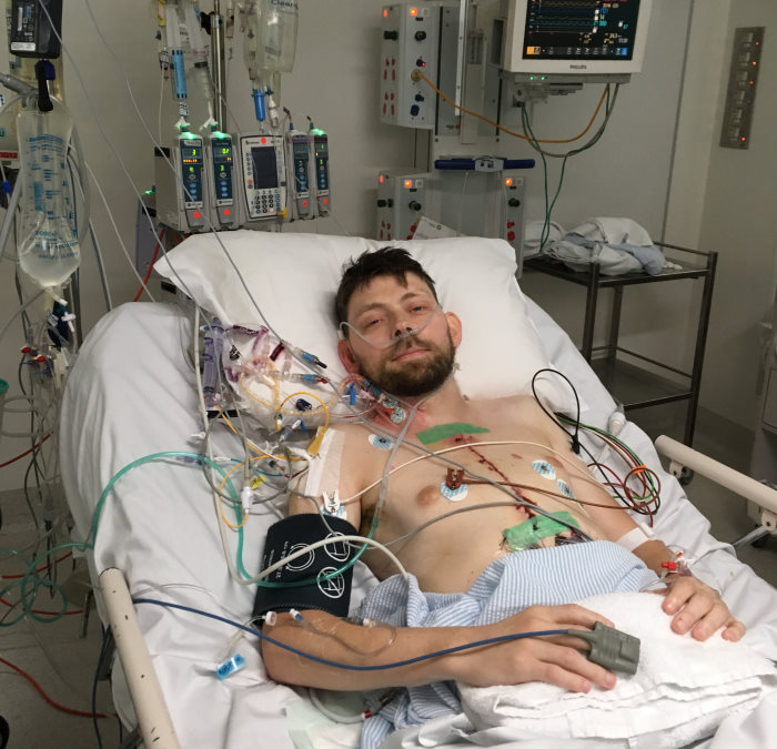 James Got a Heart Transplant in His Thirties, and Then Became a Pro ...